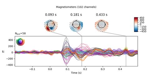 Visualizing Evoked Data — Mne 0234 Documentation