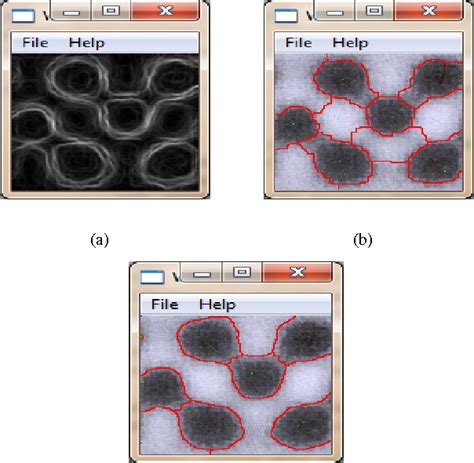 Figure 7 From A Novel Topology Based Watershed Segmentation Semantic Scholar