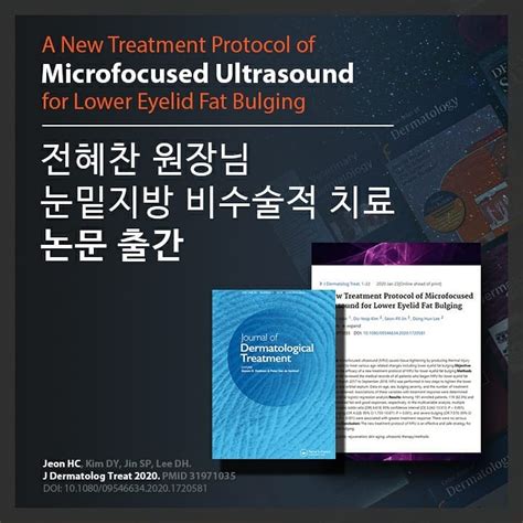 더서울피부과의원 전혜찬원장님 께서 3년간 준비하셨던 눈밑지방치료 논문이 2020년 1월 23일자로
