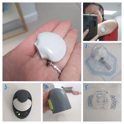 Minimed Guardian Continuous Glucose Monitoring Sensor Discount Supplier