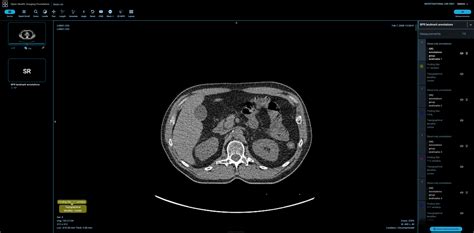 Two Server Issue Instance Level Qualitative Annotation Not Correctly Handled With Inclusion Of