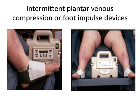 Principles Of Dvt Prophylaxis Pptx