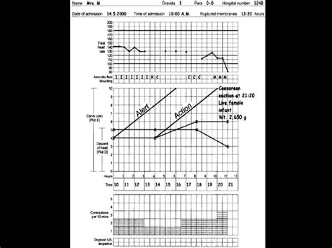 The Partograph Case Tz Ppt Free Download