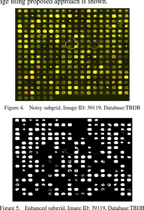 figure 4 from a fully automatic approach for enhancement of microarray images semantic scholar