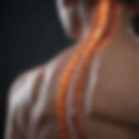 Understanding Spinal Cysts Implications And Insights