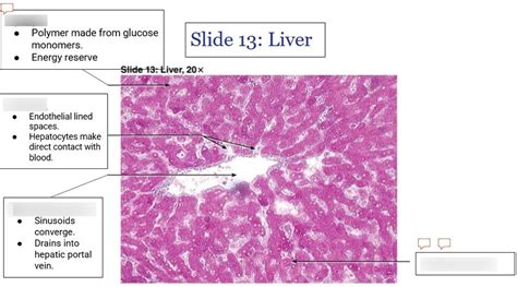Liver Diagram Quizlet