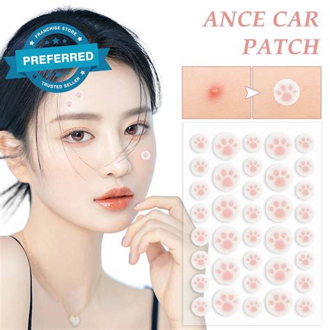 36pcs Cute Cat Paw Acne Removal Pimple Patch Ance Care Patch Z5f4
