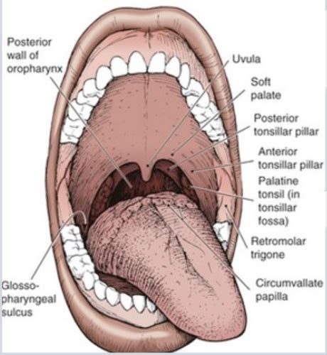 Tonsillar Fossa Lymphoma In A 28 Year Old Male Patient A On