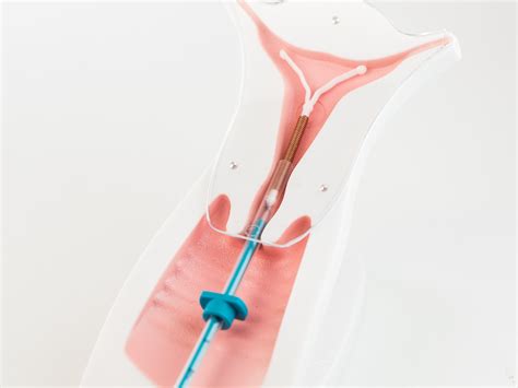 8 Iud Myths You Need To Stop Believing Business Insider