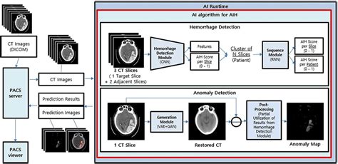 서울대 윤태진 아주대 최진욱 교수팀 Ai 뇌출혈 영상 의료 솔루션 효과성 입증
