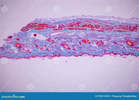 Characteristics Tissue Of Human Scalp Skin Human From General Body