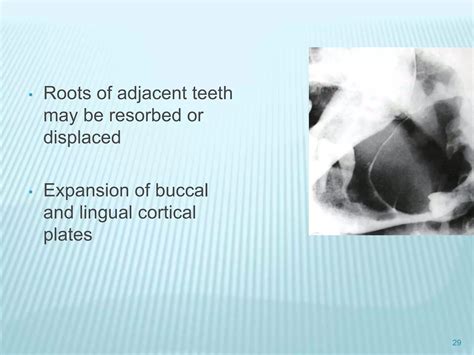 Odontogenic Tumor 2022pptx Dental Health Diseases And Conditions
