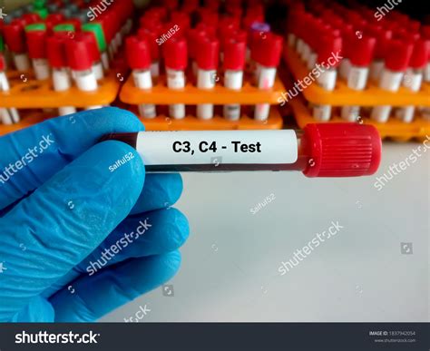 Blood Sample C3 C4 Complement Test ภาพสตอก 1837942054 Shutterstock