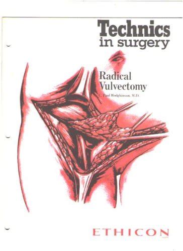Radical Vulvectomy Technics In Surgery In Pakistan WellShop Pk