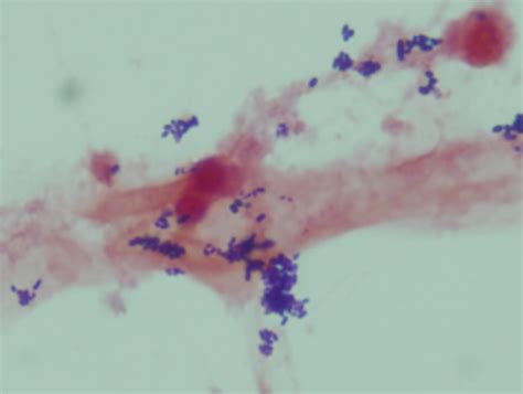 Gram Staining Flashcards Quizlet