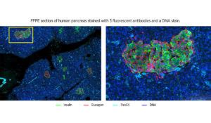 GeoMx Morphology Markers NanoString