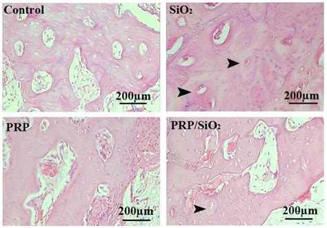 Comparison Of The Histological Sections From The Mandibular Bone Download Scientific Diagram