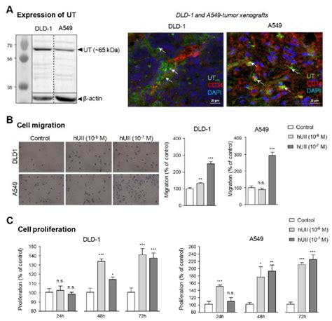 Ut Expression In Dld 1 And A549 Cell Lines And Effect Of Huii On