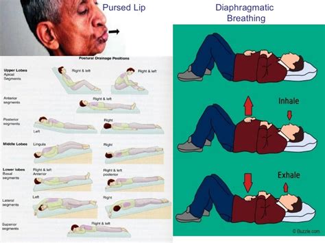 Pulmonary Rehabilitation