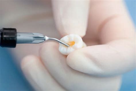 Trusfil Flow Flowable Composite Restorative Resin Huge Dental