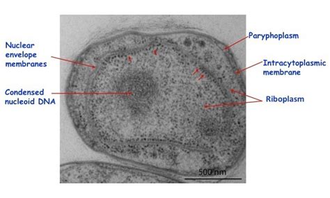 Prokaryote Celler Mikroskop De Eukaryotische Cel De Wereld Onder De