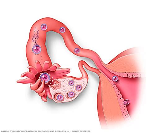 Pregnancy Infertility