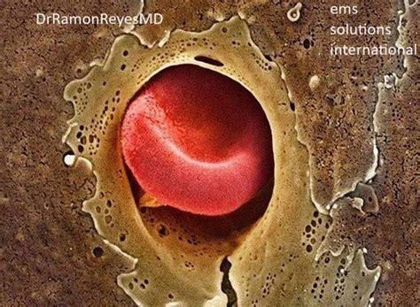 EMS SOLUTIONS INTERNATIONAL By DrRamonReyesMD Marca Registrada Sangre Sus Componentes Y Derivados
