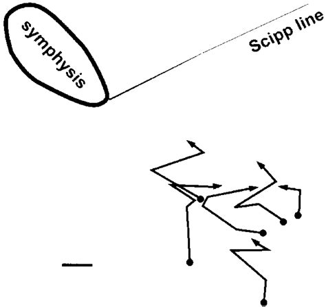 Displacement Of The Perineal Body At Each Follow Up Examination In Download Scientific Diagram