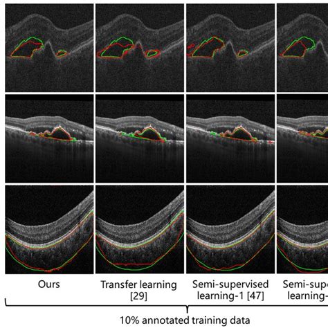 Model Architectures Of A The Masked Self Supervised Generative Download Scientific Diagram