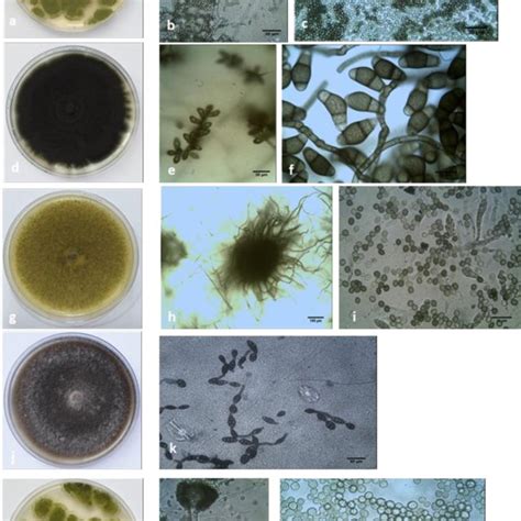 Aspergillus Flavus Mrds 301 A Colony Morphology B Conidiophores And