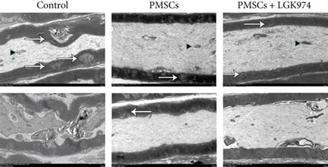 after transplantation the structure of sciatic nerve was observed