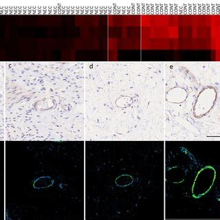 Two Dimensional Hierarchical Clustering Generated Four Clinical Groups