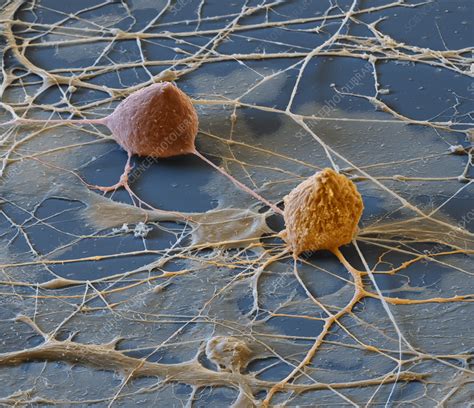 Spinal Ganglion Nerve Cells Sem Stock Image C0578368 Science