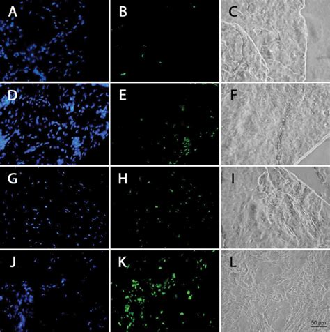 In Situ Apoptosis Detection In Rotator Cuff Tears Dna Fragmentation