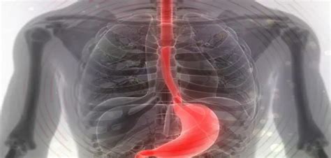 New Genomic Technique Identifies Roots Of Upper Gi Cancers