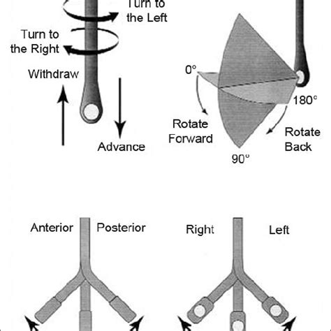 Components Of An Ultrasound Transducer Download Scientific Diagram