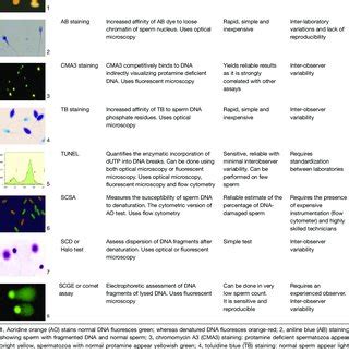 Sperm DNA Fragmentation Testing Methods Download Table