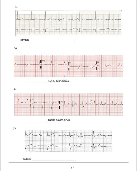 2024 Updated Ekgecg Heart Arrhythmias Study Guide 55 Pages 35