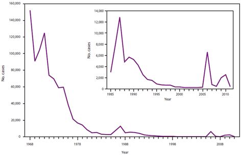 Mumps Diagram