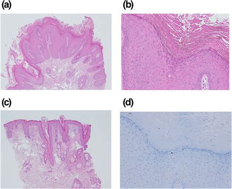 Histological And Immunohistochemical Findings Of The Lesions Download Scientific Diagram