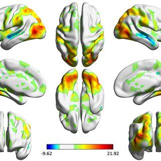 PDF Understanding Heterosexual Women S Erotic Flexibility The Role Of Attention In Sexual