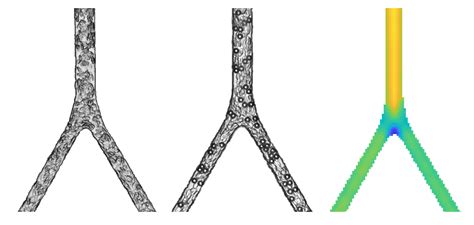 Biomedical Flows Experimental Fluid Dynamics Eth Zurich