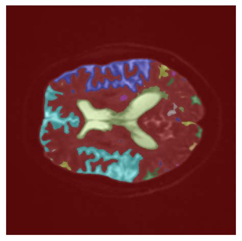 Theres More Python Image Processing Cookbook Book