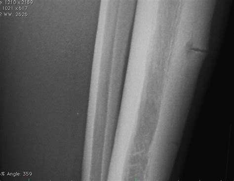 April Steiner Bennett Magnacares Uk