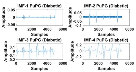 First Four Intrinsic Mode Functions Of A Diabetic Signal Download
