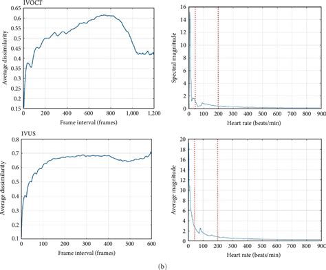 Figure 17 From An Unsupervised Deep Learning Framework For Retrospective Gating Of Catheter