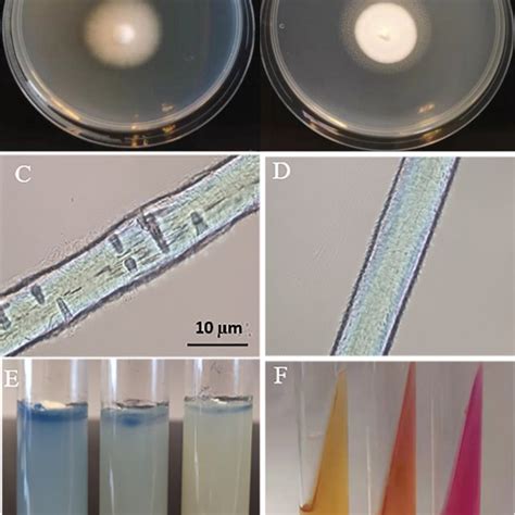 Pdf Taxonomy Of The Trichophyton Mentagrophytes T Interdigitale Species Complex Harboring The