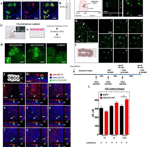 Choroid Plexus Explants Maintain Epithelial Cell Polarization A Download Scientific Diagram