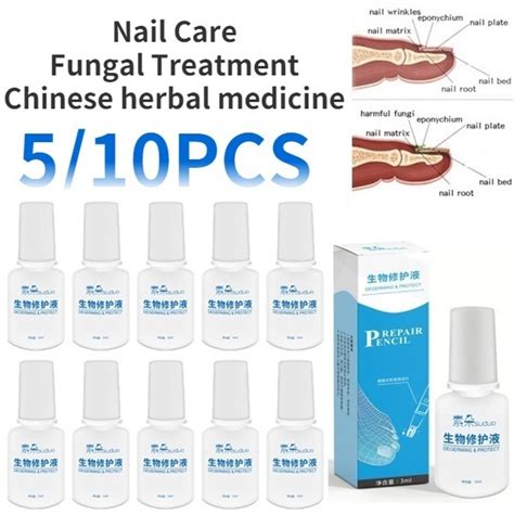 2022 New 10ml 1pc Chinese Medicine Herbs Toe Nail Fungus Treatment