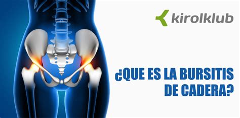 Bursitis De Cadera Kirolklub